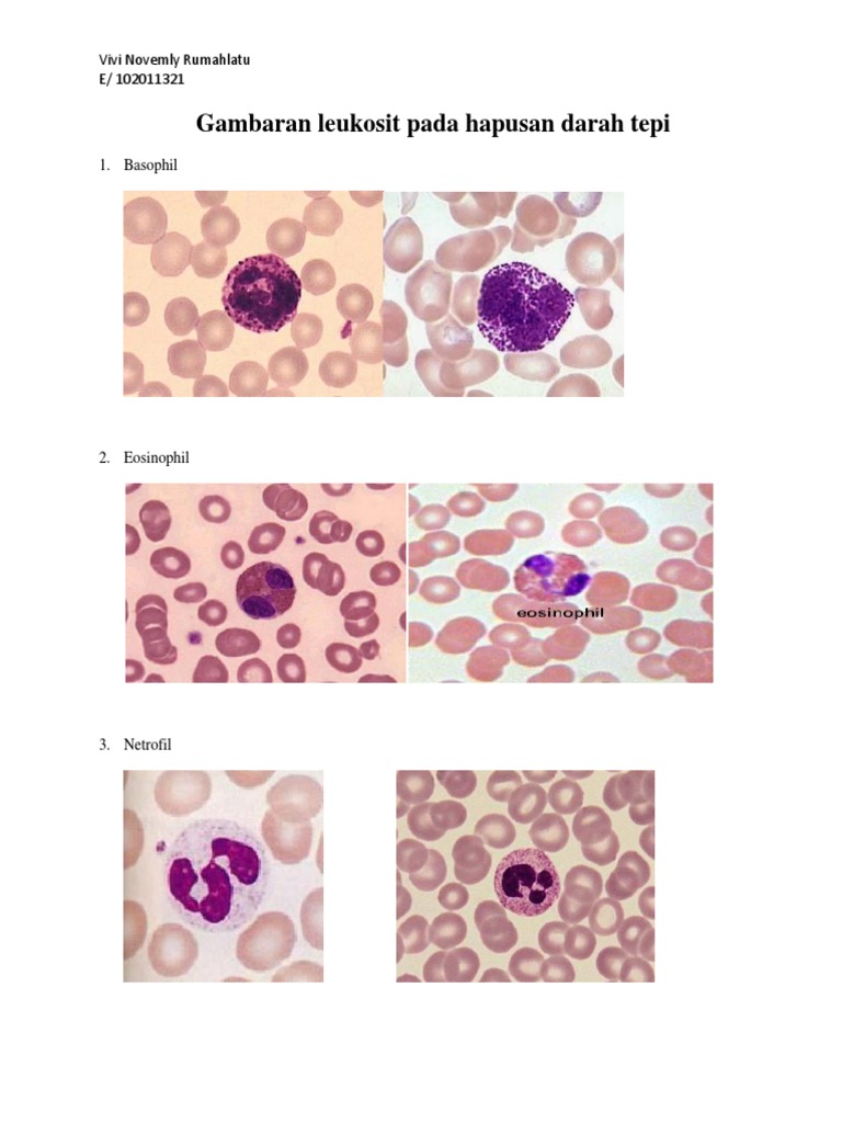 Gambaran Leukosit Pada Hapusan Darah Tepi | PDF