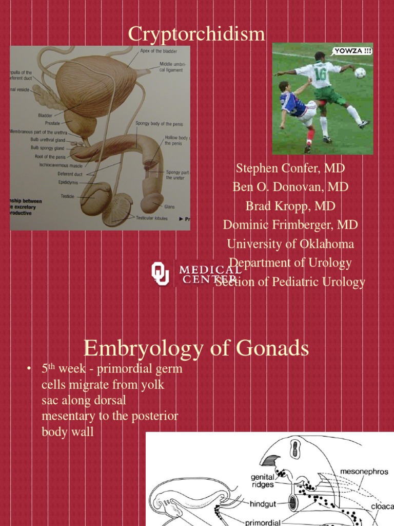 Cryptorchidism Guide: Embryology, Causes, Classification | PDF ...