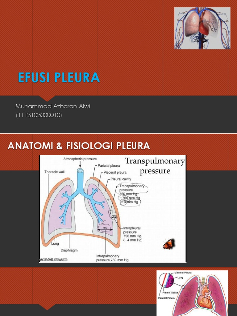 Efusi Pleura | PDF
