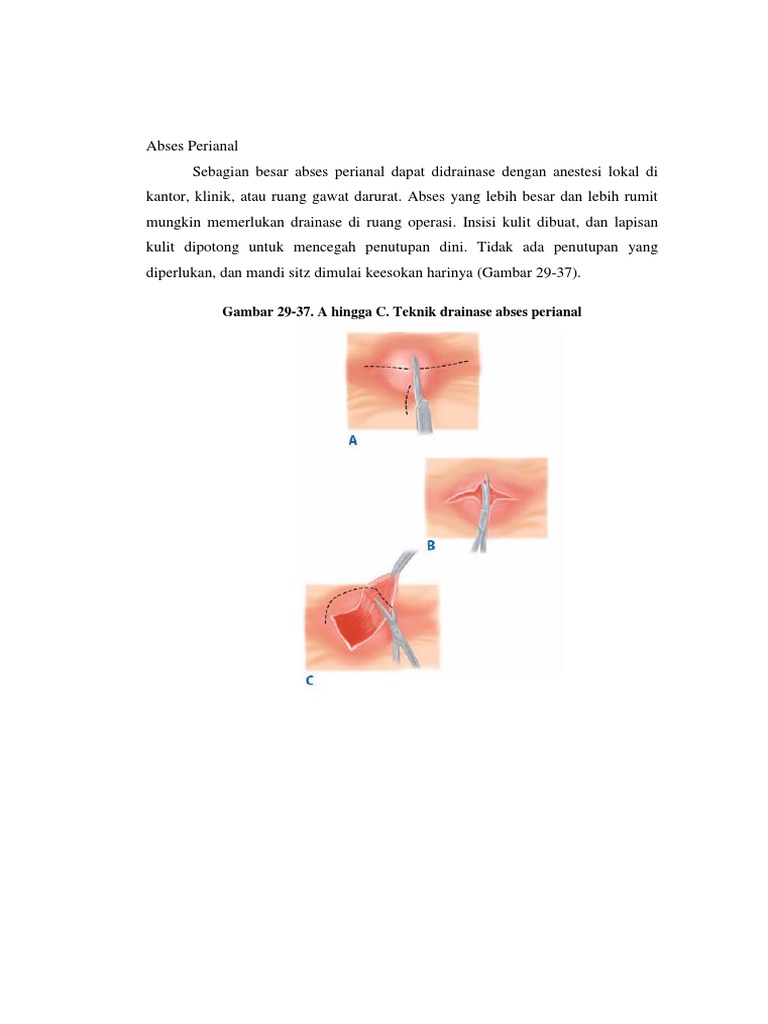 Abses Perianal dan Hemoroid: Diagnosis dan Pengobatan | PDF | Gaya Hidup