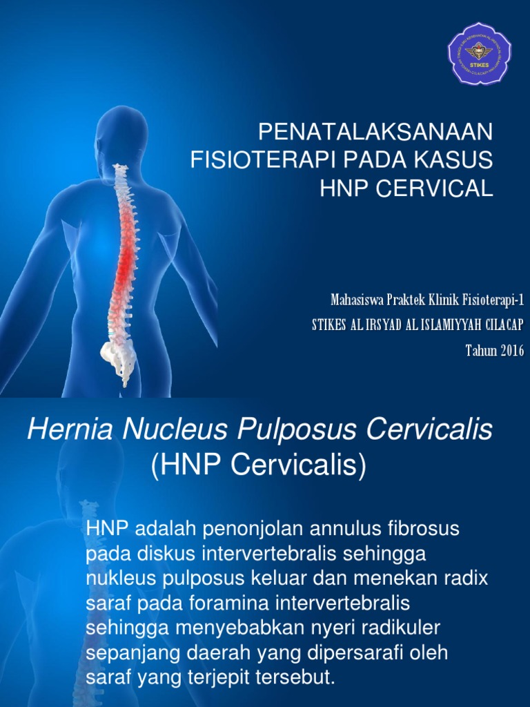 Fisioterapi HNP Cervical: Studi Kasus | PDF | Kesehatan Holistik ...