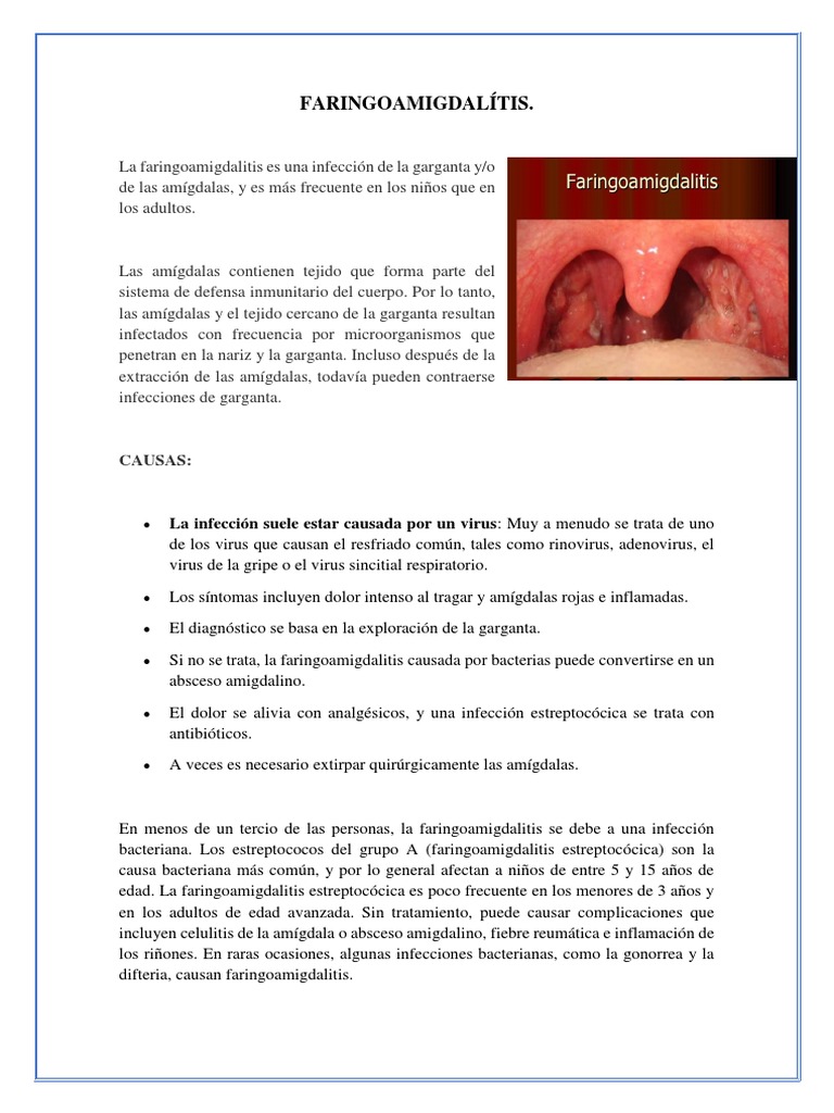 FARINGOAMIGDALÍTIS | PDF | Resfriado comun | Rtt