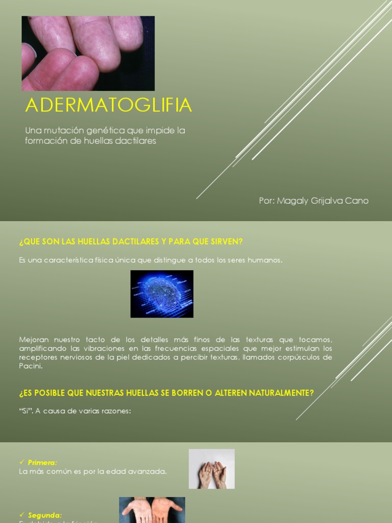 Adermatoglifia Presentación | Huella dactilar | Biología
