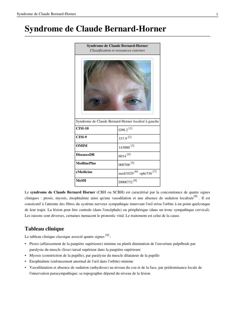 Syndrome de Claude Bernard-Horner | PDF | Ophtalmologie | Médecine