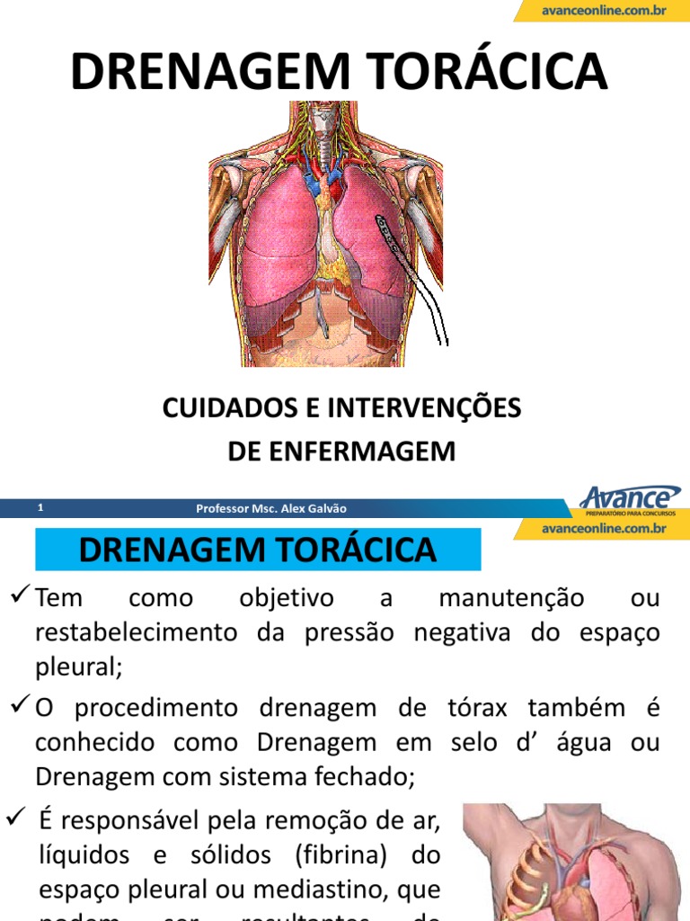 DRENAGEM TORÁCICA | Especialidades Médicas | Medicina clínica