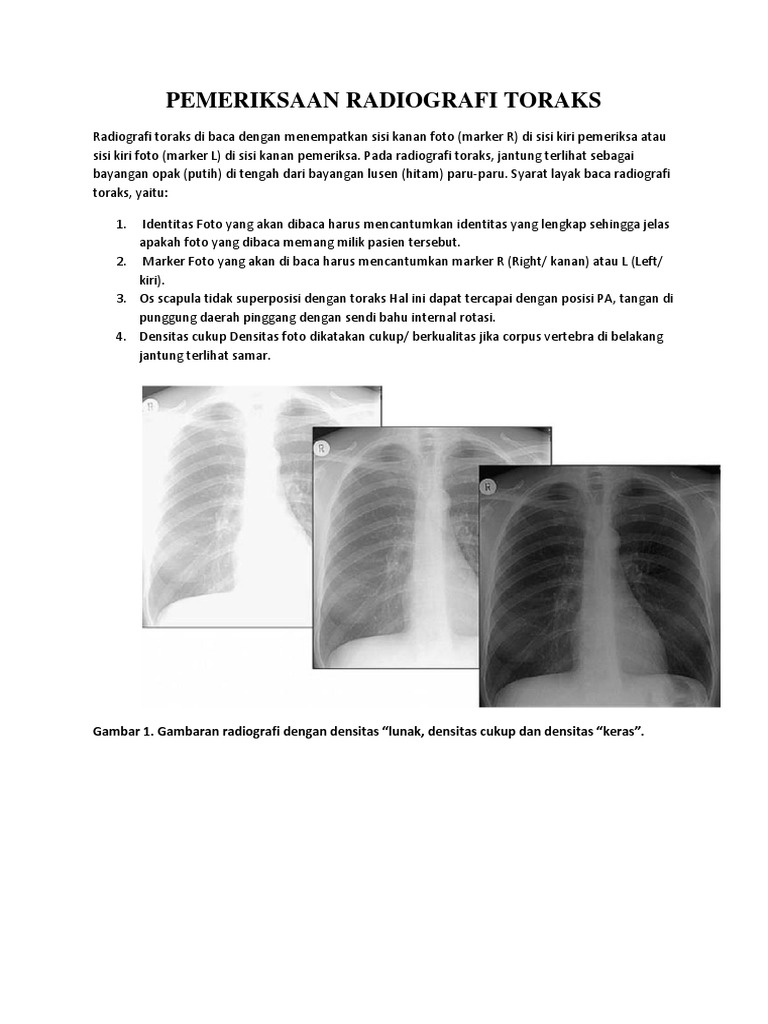 Pemeriksaan Radiografi Toraks | PDF