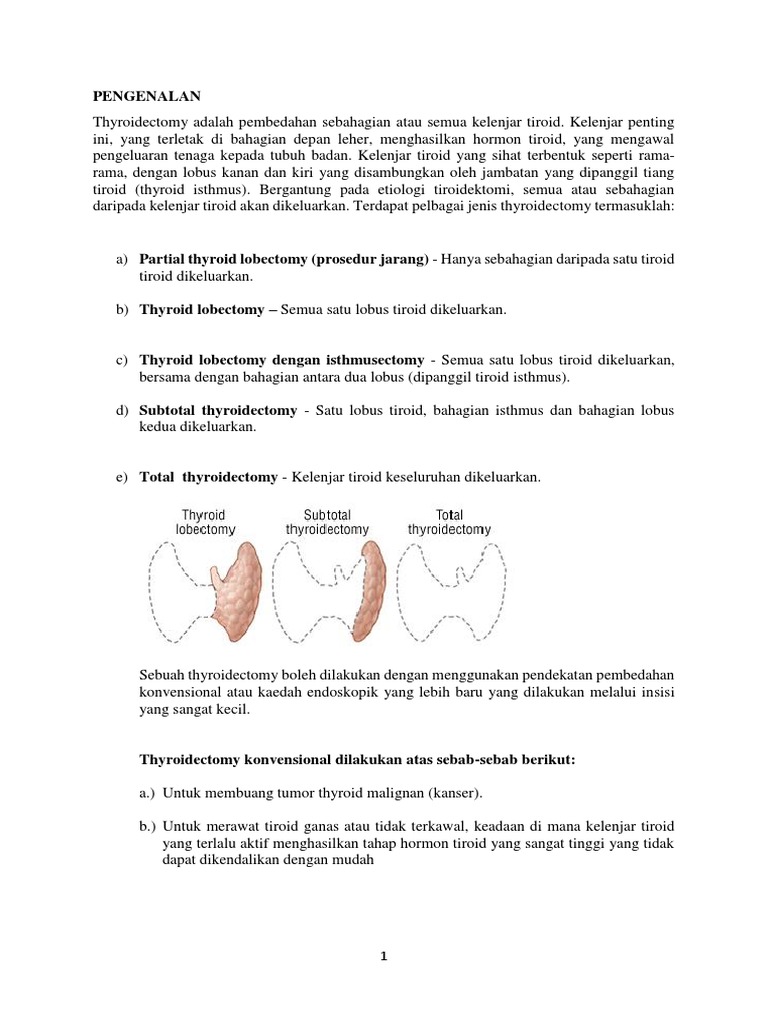 Case Study Total Thyroidectomy + Papillary Thyroid Carcinoma With Metastases | PDF