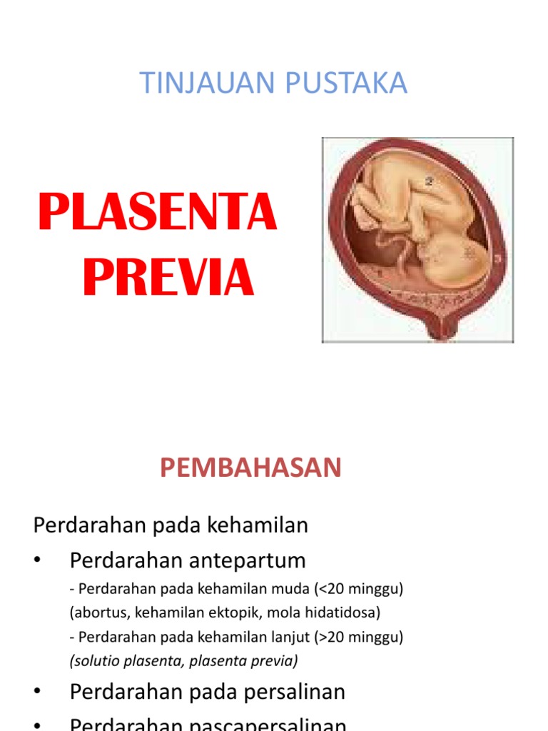 Plasenta Previa | PDF