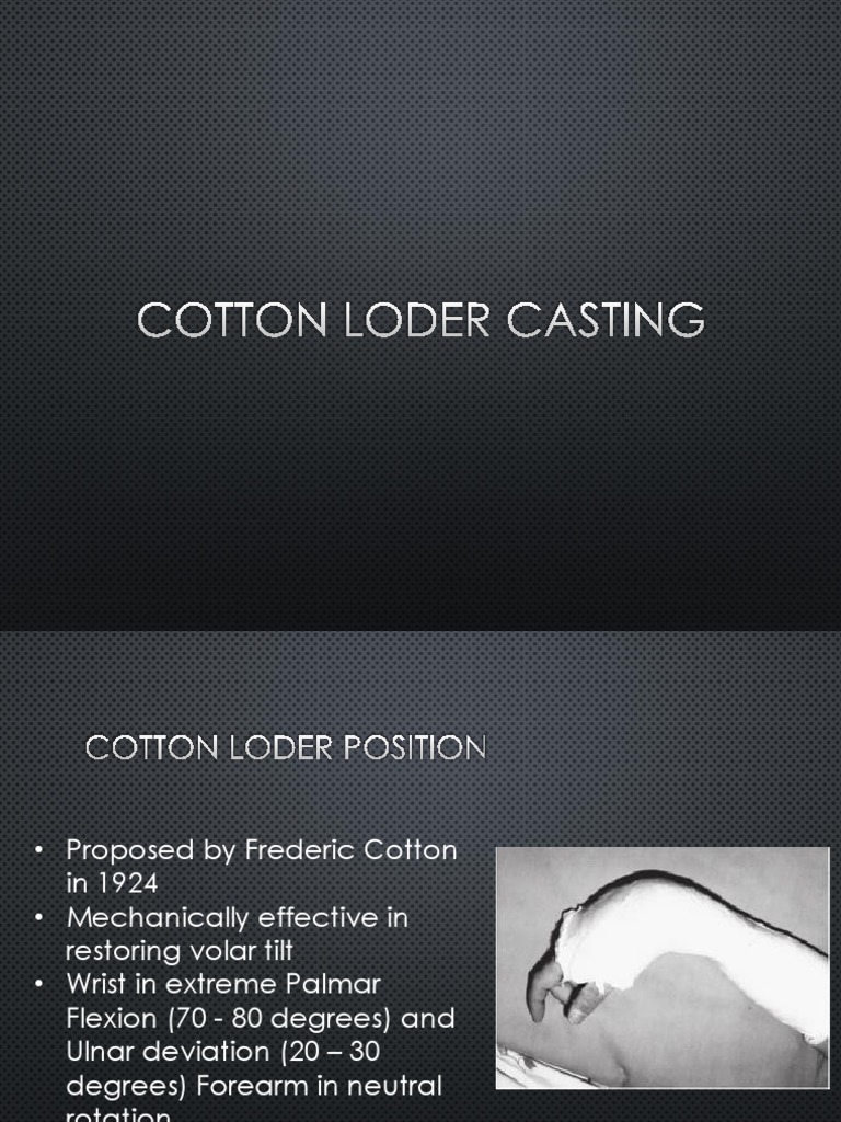 Cotton Loder Casting | PDF | Hand | Joints