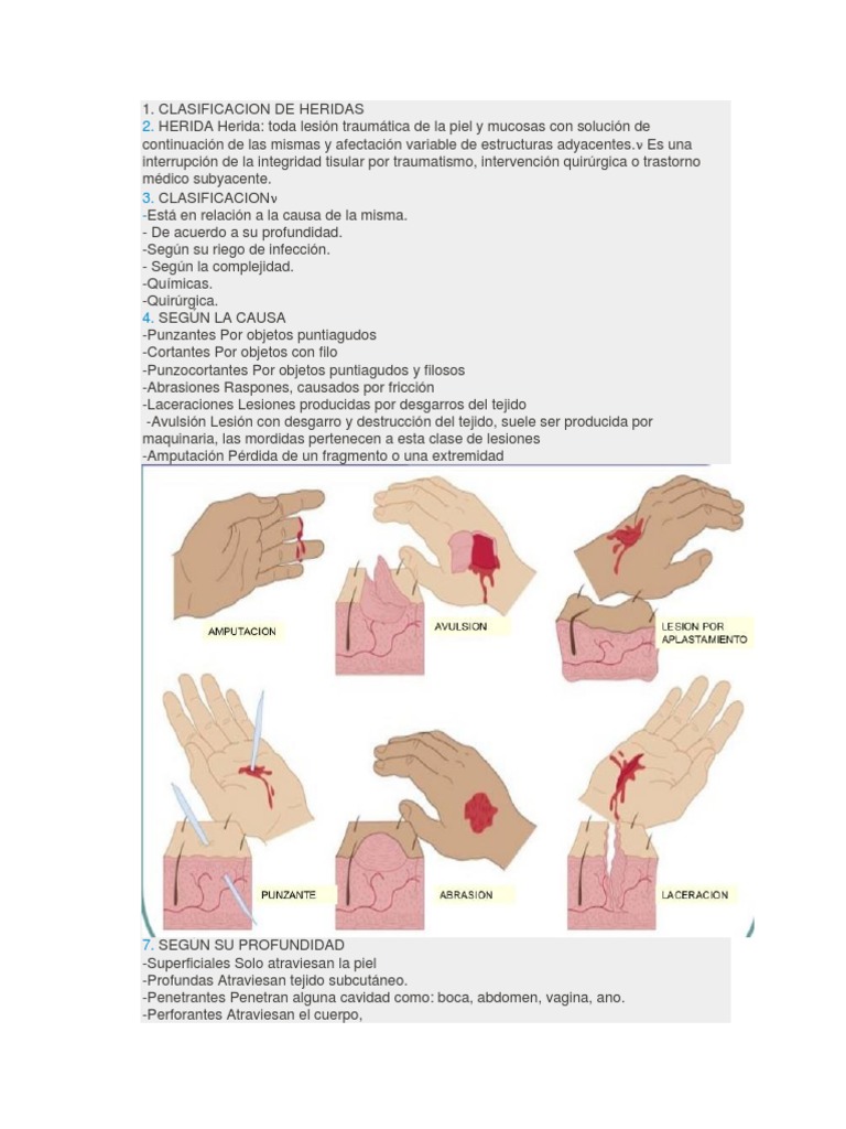 Clasificacion de Las Heridas Explicadas | PDF | Herida | Lesión