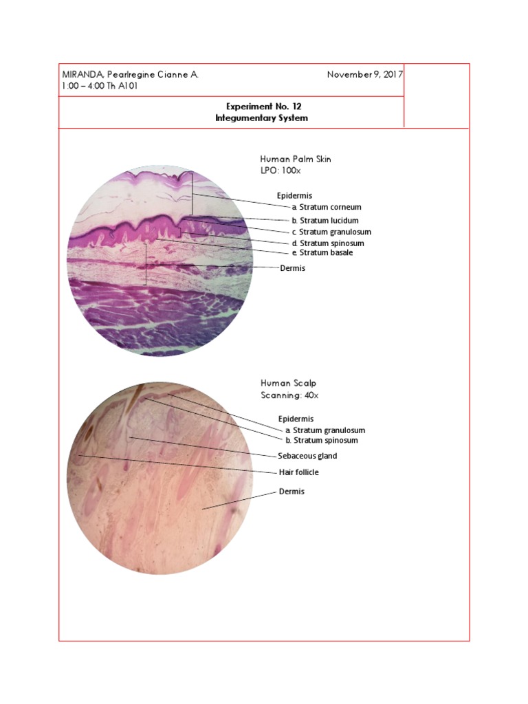 HIstology Experiment 12 | PDF | Skin | Epidermis