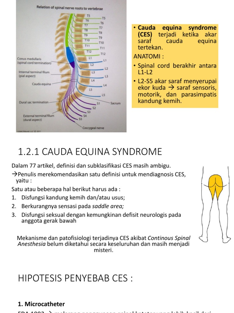Cauda Equina Syndrom | PDF