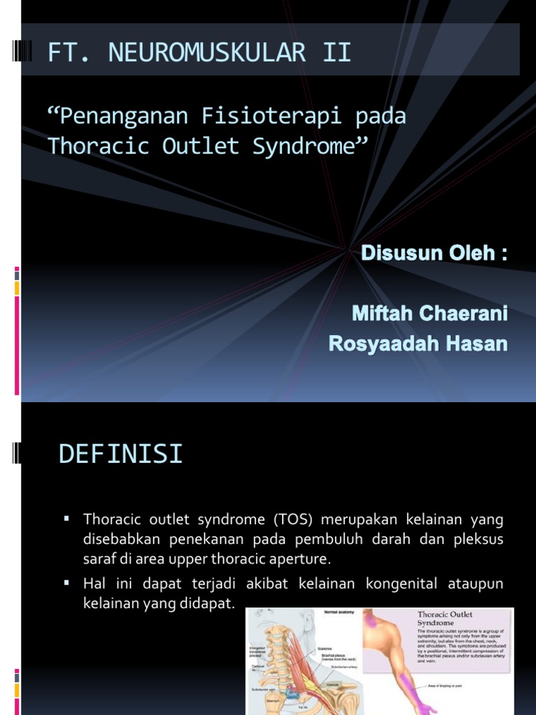Penanganan Fisioterapi Pada Thoracic Outlet Syndrome. | PDF