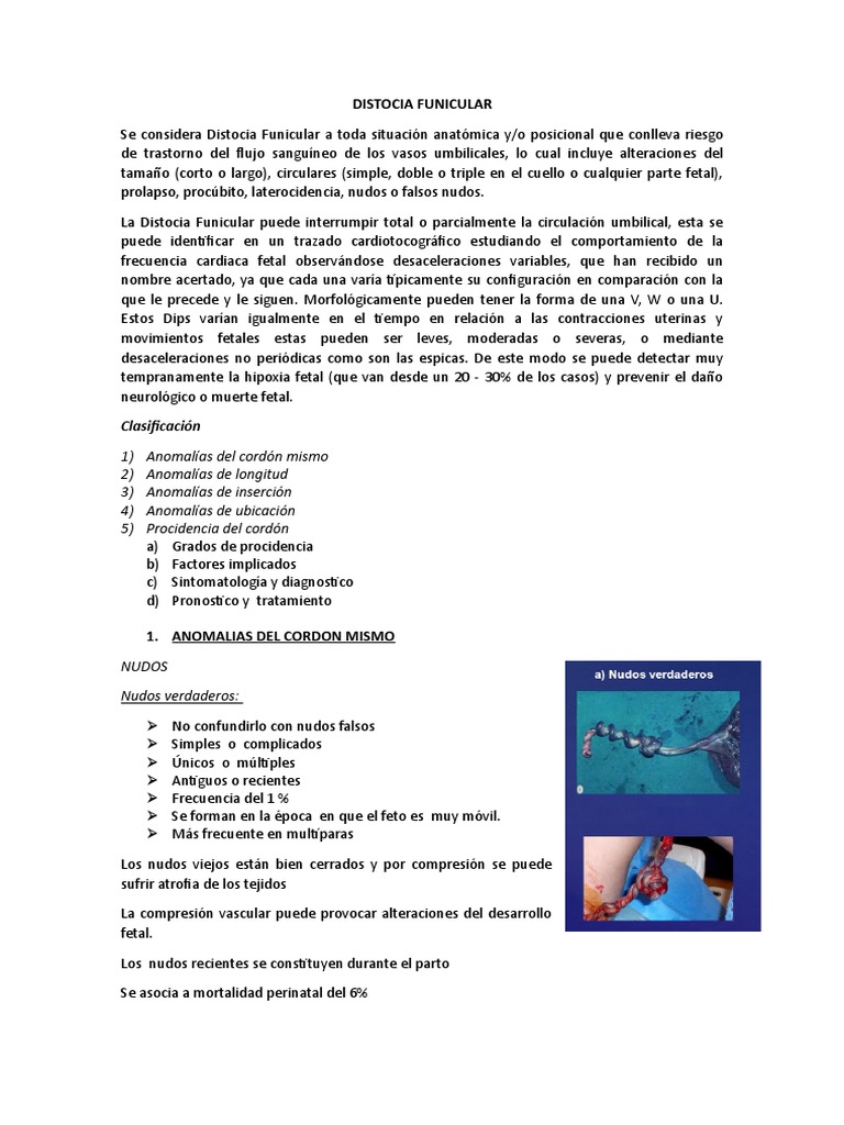 Distocia Funicular: Clasificación y Riesgos | PDF | Parto ...