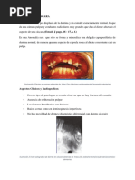 Canino Temporal Superior | PDF | Anatomia dental | Diente