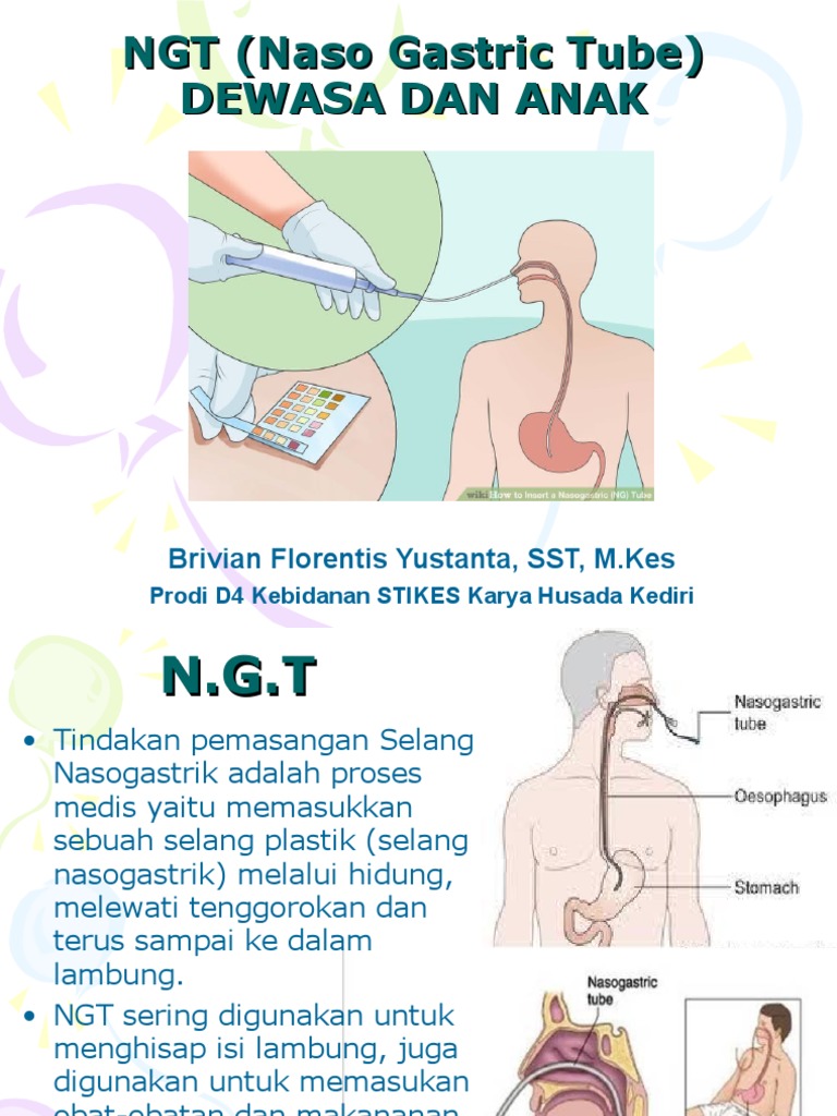 NGT (Naso Gastric Tube) DEWASA DAN ANAK | PDF