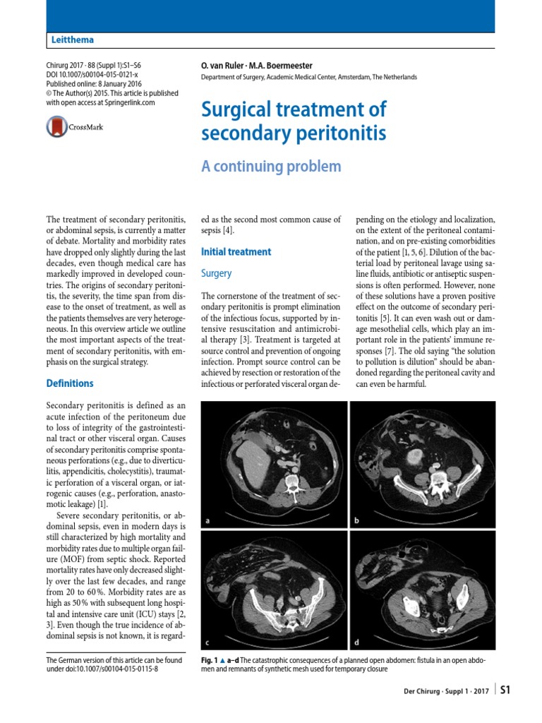 Surgical Treatment of Secondary Peritonitis: A Continuing Problem ...