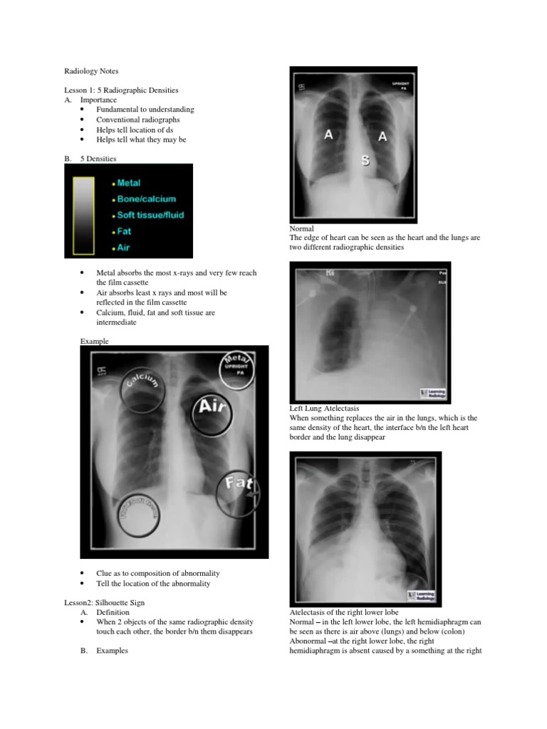 Radiology Notes | PDF | Radiography | Lung