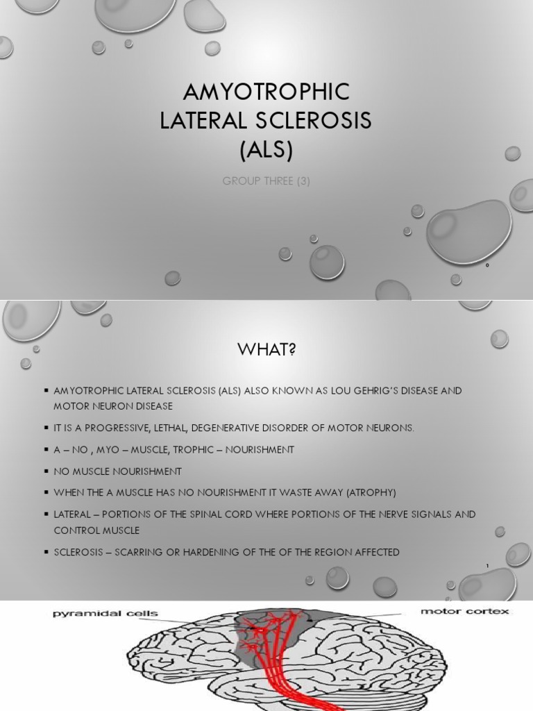 Amyotrophic Lateral Sclerosis (ALS) : Group Three | PDF | Amyotrophic ...