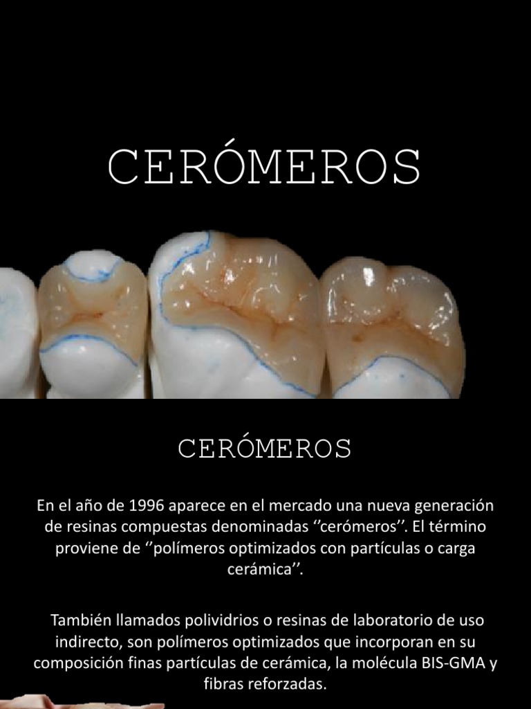 CERÓMEROS | Lentes | Aluminio