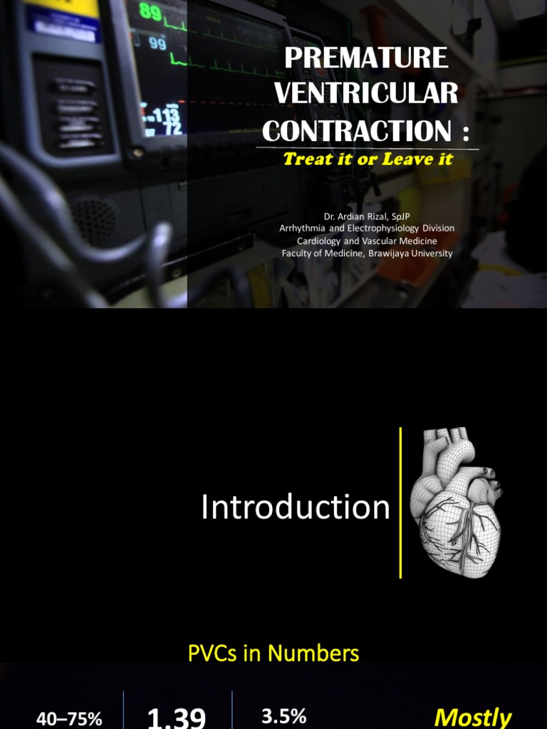 Premature Ventricular Contraction:: Treat It or Leave It | PDF | Heart ...