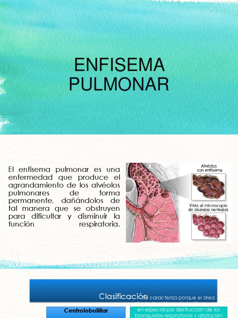 enfisema pulmonar | Pulmón | Fumar tabaco
