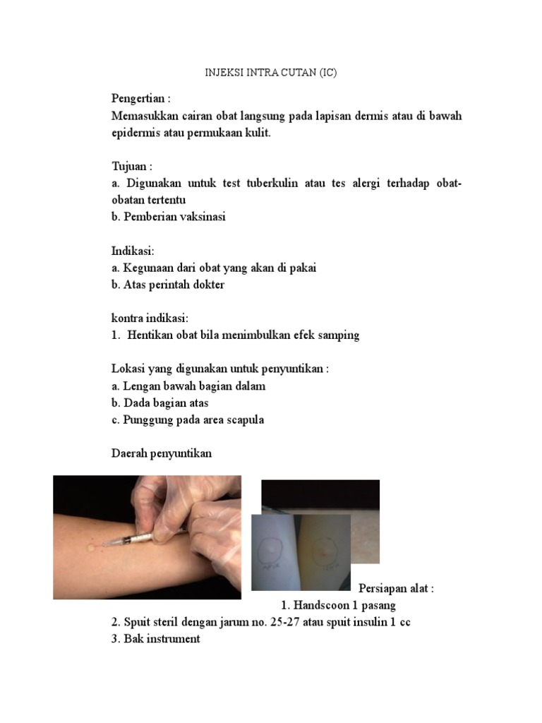 Prosedur Injeksi Intrakutan IC | PDF