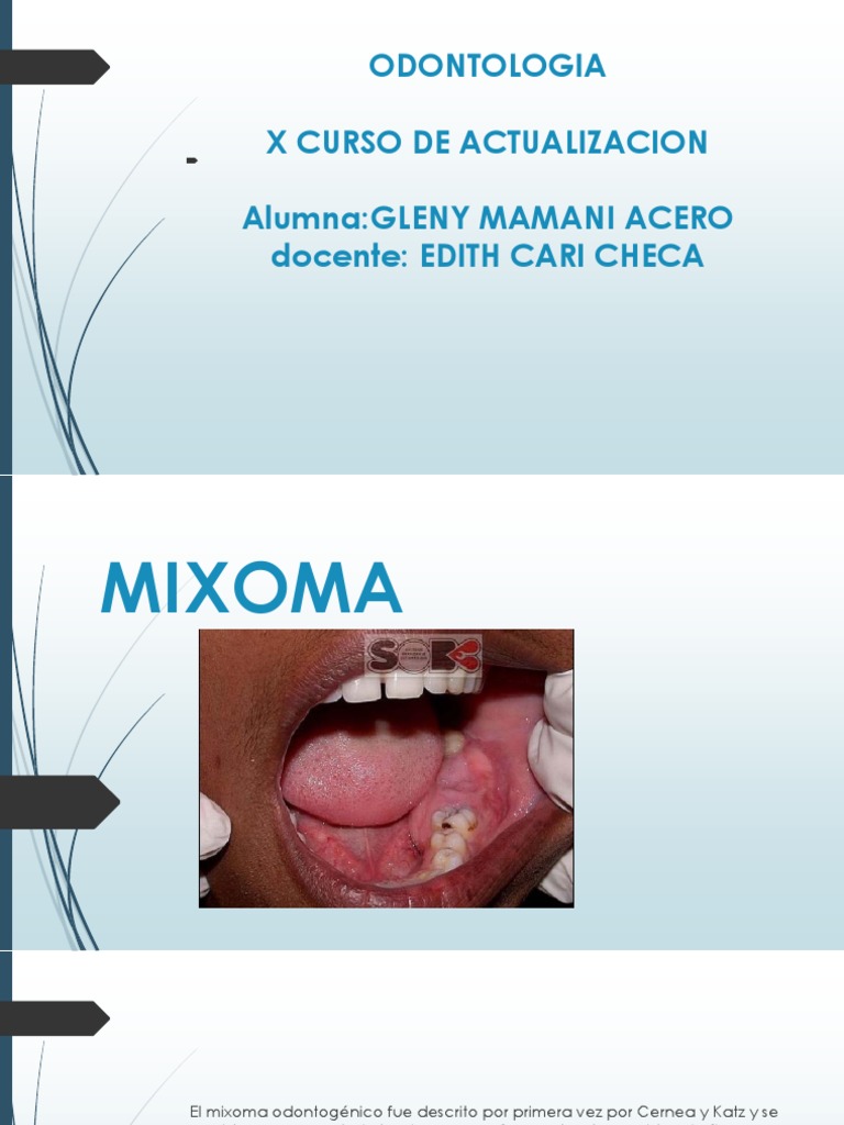 Características clínicas, radiológicas e histológicas del mixoma ...