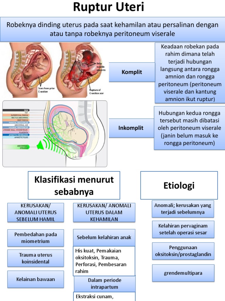 Ruptur Uteri | PDF