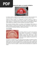 Protocolo Impresión Definitiva para Protesis Total | PDF | Dentadura ...