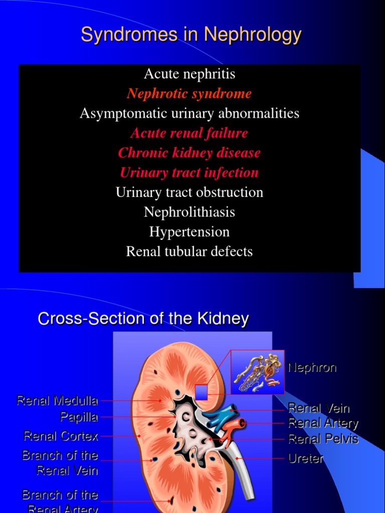283706312-Nephrotic-Syndrome.ppt | Kidney | Urinary System