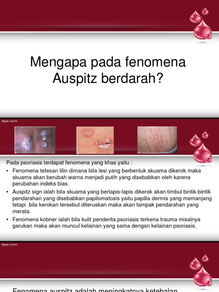 PR DR Haekal Auspitz Sign | PDF