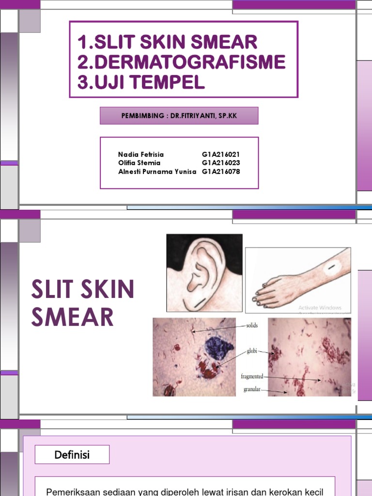 Panduan Pemeriksaan Kusta | PDF | Seni | Kesehatan Holistik