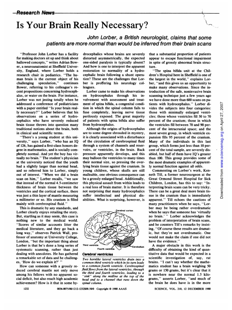 No Brain and Still Conscious? | PDF | Sat | Brain