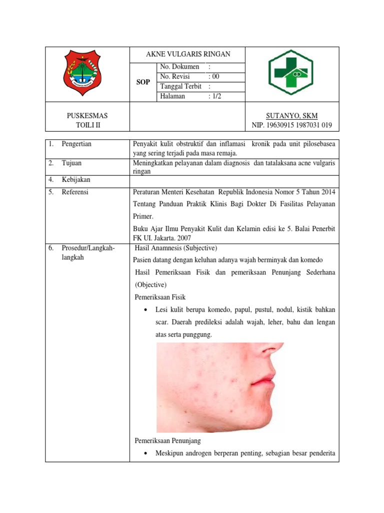 Sop Akne Vulgaris Ringan | PDF