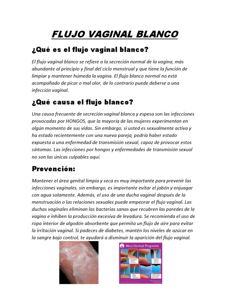 Flujo Vaginal Blanco: Causas y Signos | PDF | Vagina | Candidiasis