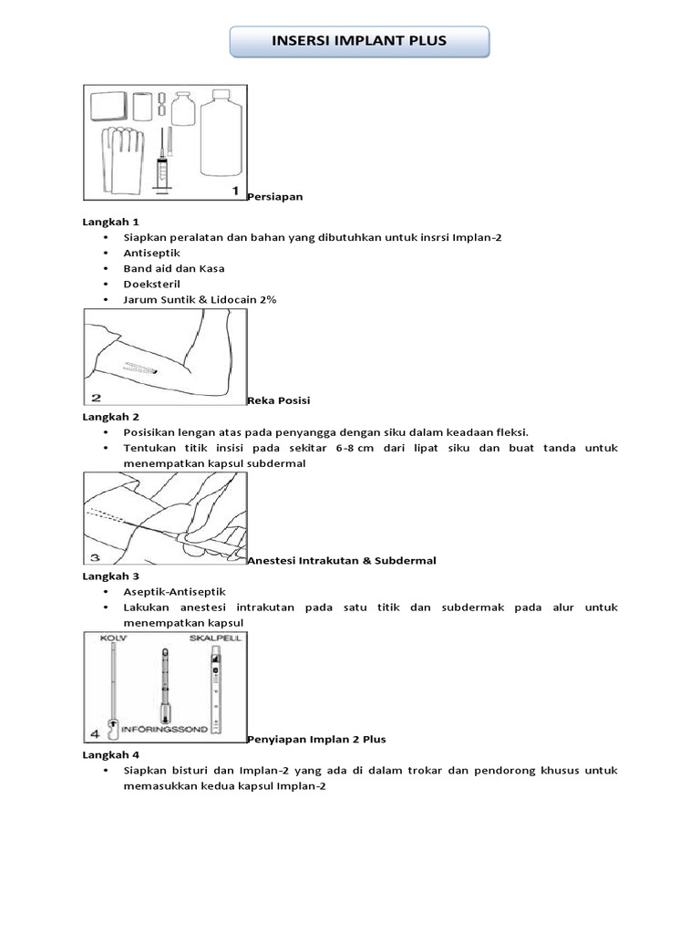 Insersi Inplant Plus | PDF | Bisnis