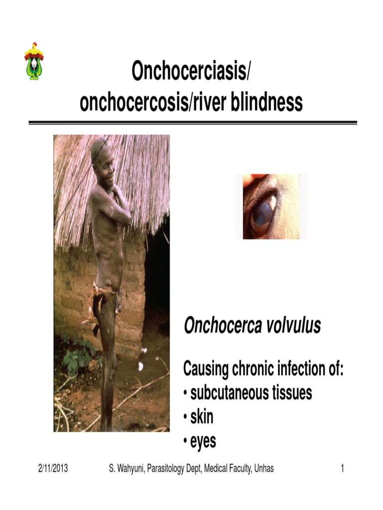 Onchocerciasis & Loa Loa Overview | PDF | Cutaneous Conditions ...