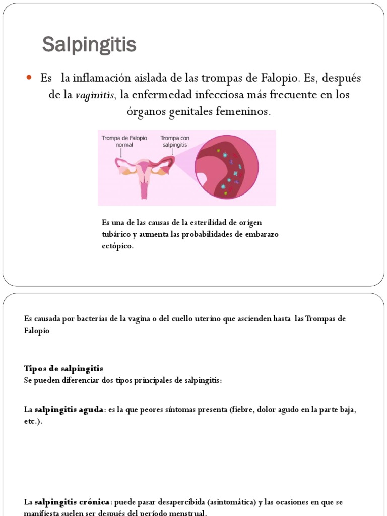 Salpingitis: Tipos y Síntomas | PDF | Inmunología | Reproducción humana