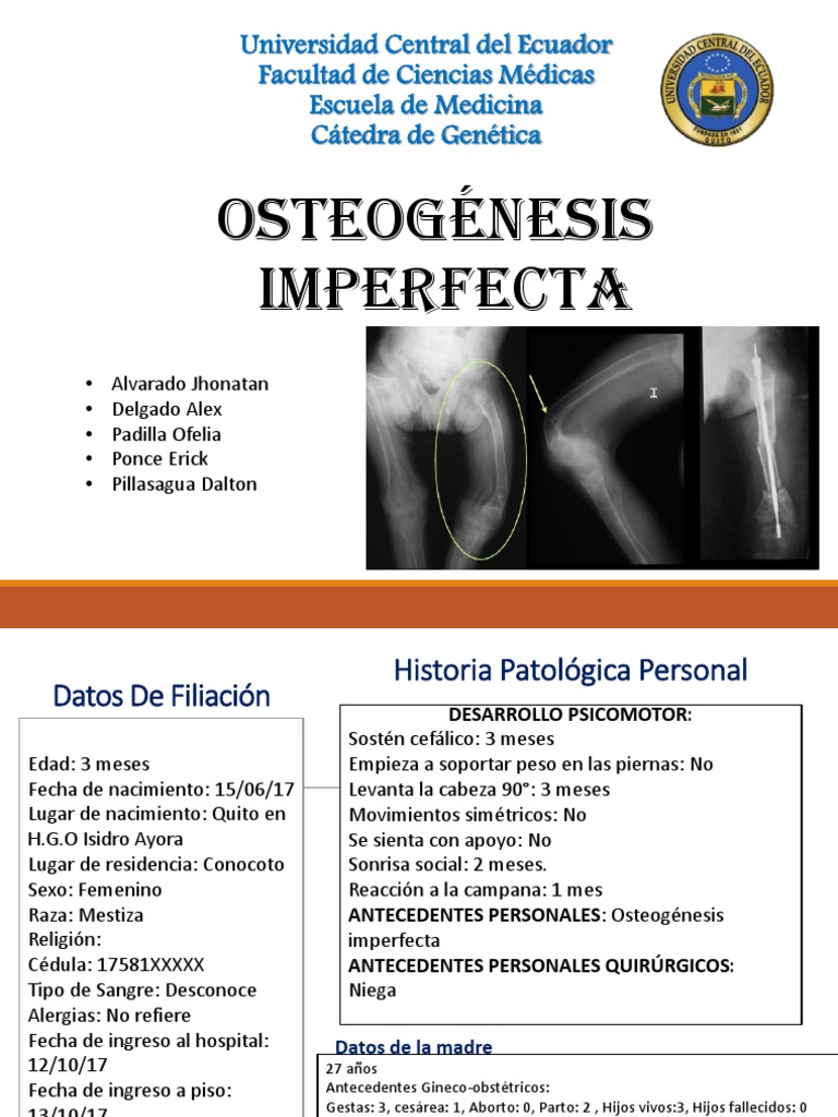 Osteogenesis Imperfecta | PDF | Mutación | Gene