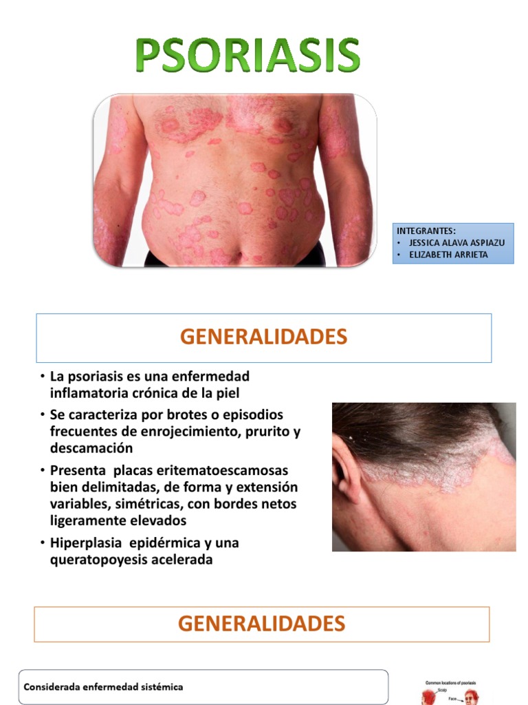 Características clínicas y patogénesis de la psoriasis | PDF | Psoriasis | Biología Celular