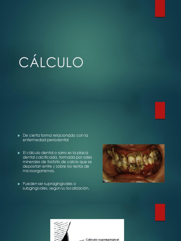 Cálculo Dental: Supragingival y Subgingival | PDF | Diente | Las bacterias
