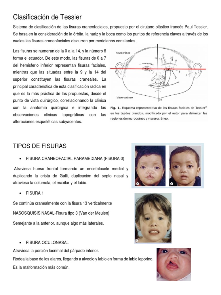 Tessier | PDF | Cara | Sistema musculoesquelético