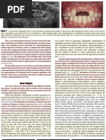 Straumann® Guided Surgery System Instruments | PDF | Dental Implant ...