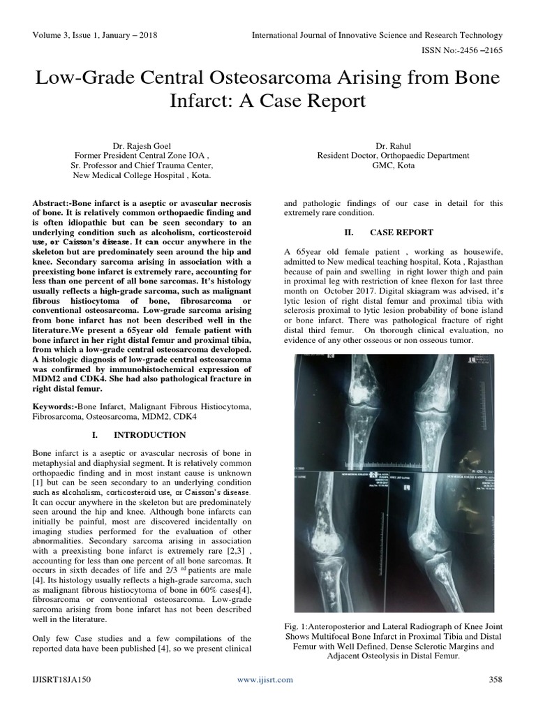 Low Grade Central Osteosarcoma Arising From Bone Infarct A Case Report ...