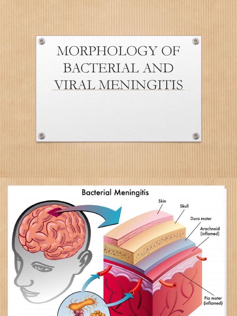 Morphology of Bacterial and Viral Meningitis | PDF