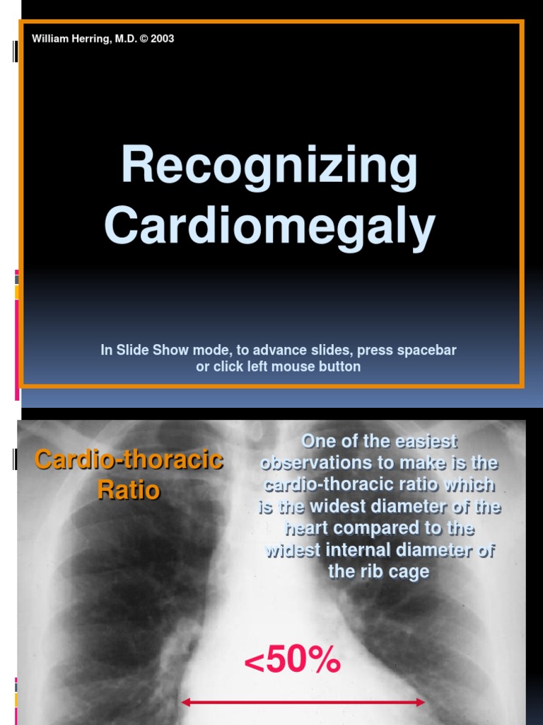 Understanding Cardiomegaly Diagnosis | PDF | Thorax (Human Anatomy ...