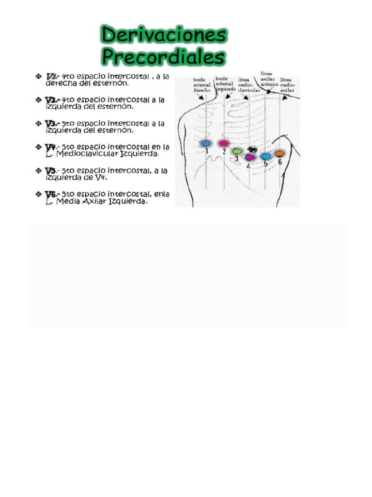 Correlación ECG y Paredes Cardiacas | PDF