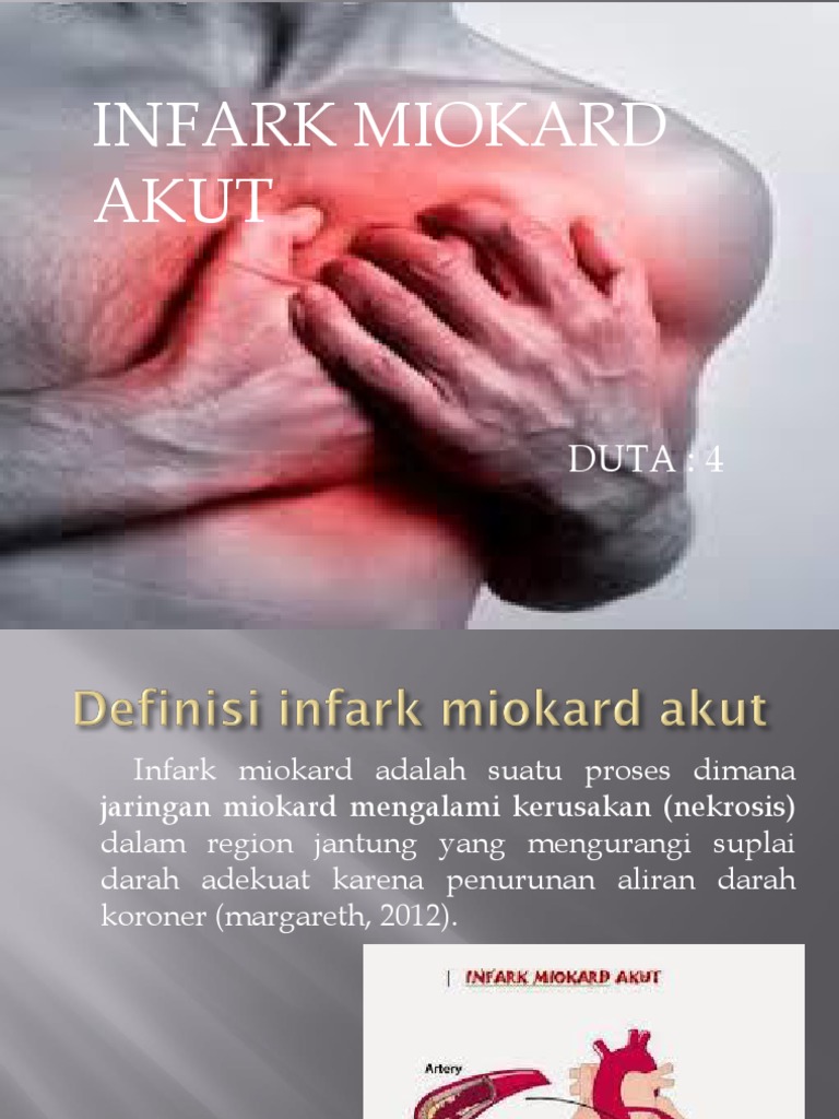 Infark Miokard Akut | PDF | Pengembangan Diri