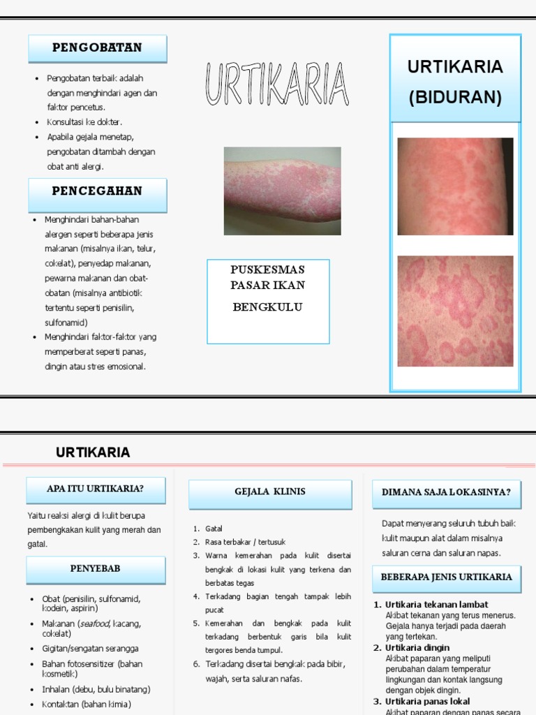 Leaflet Urtikaria | PDF